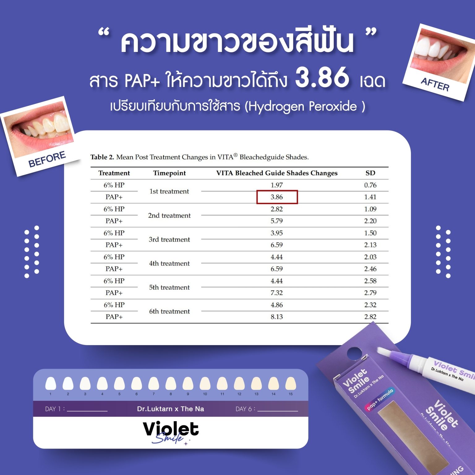 Violet Smile Pen รับรองด้วยงานวิจัย